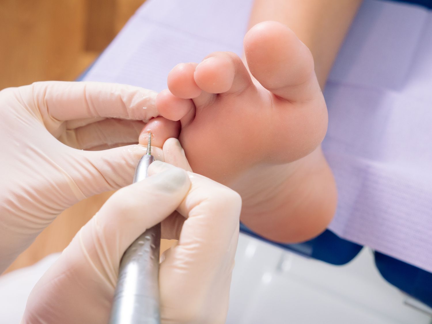 Routine Podiatry - Llandovery Podiatry